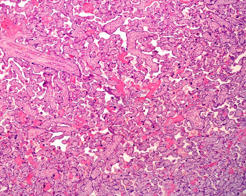 Human placenta stock image. Image of tissue, histological - 324197585