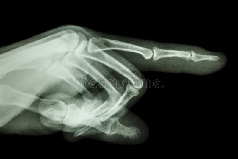 Human is Pointing the Finger Stock Photo - Image of bone, exam: 38652160