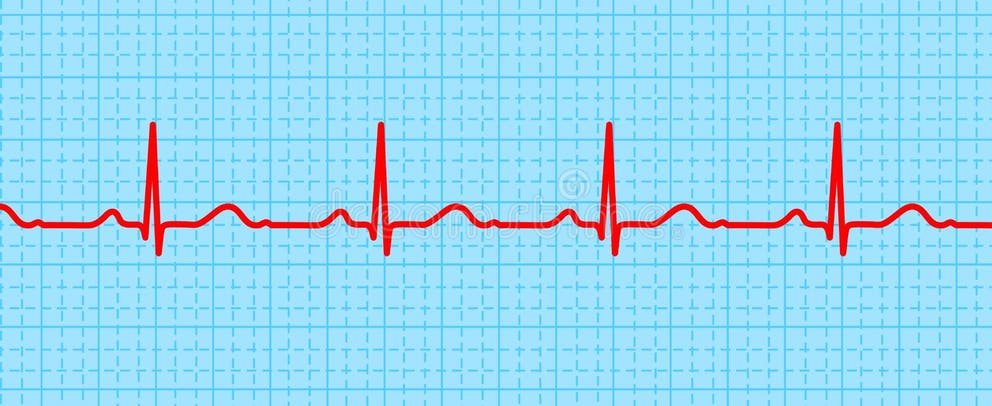 Human Pulse Background Stock Illustrations – 16,231 Human Pulse ...