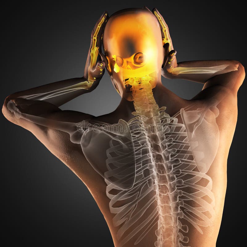 Human Bones Radiography Scan Image Stock Illustration - Illustration of ...