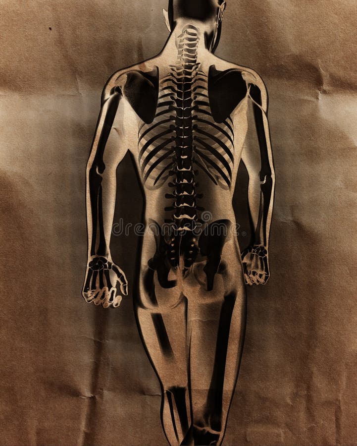 Human Radiography Scan with Bones Painted Stock Image - Image of joint ...