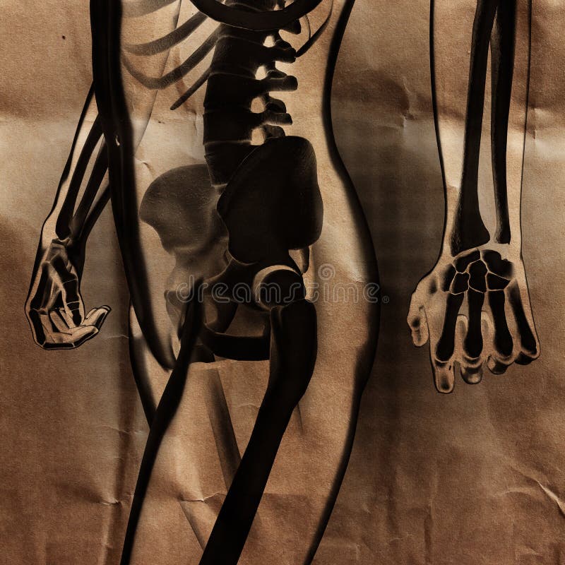 Human Radiography Scan with Bones Painted Stock Image - Image of black ...