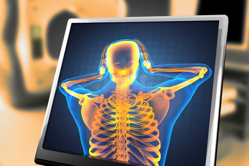 Human radiography scan stock image. Image of body, medicine - 60715851