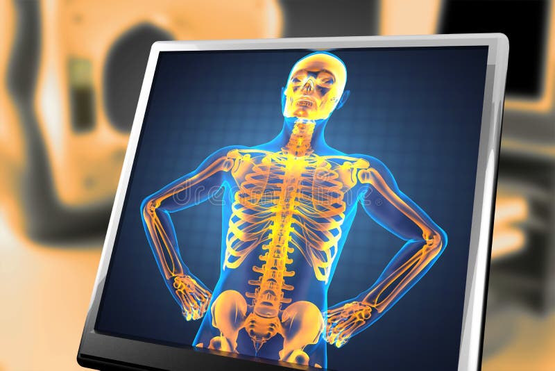 Human radiography scan stock illustration. Illustration of joint - 60716010