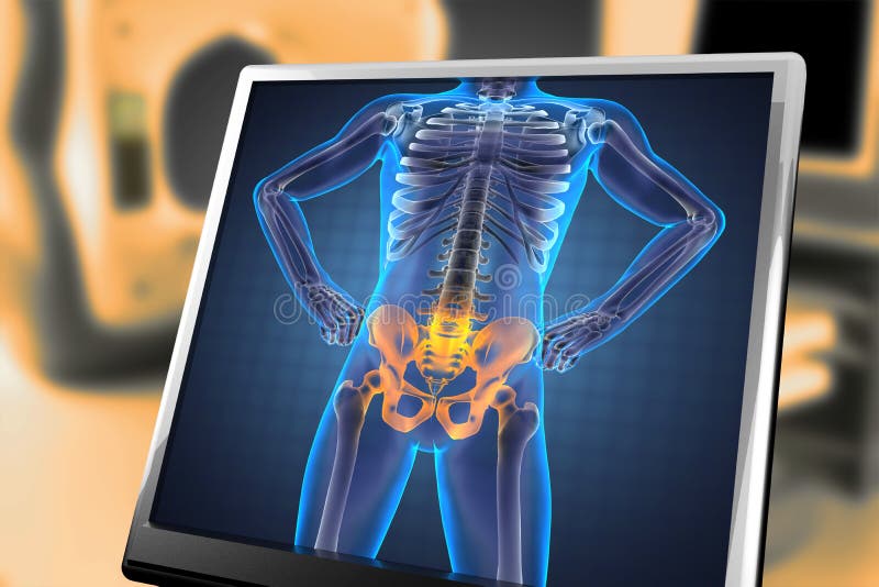 Human radiography scan stock illustration. Illustration of doctor ...