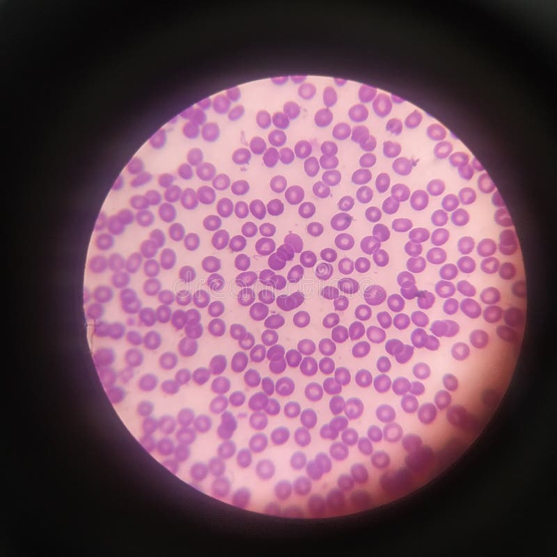 Human red blood cells RBCs stock image. Image of appearance - 287313041