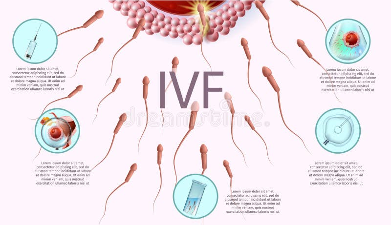 Ivf Banner Stock Illustrations – 261 Ivf Banner Stock Illustrations ...