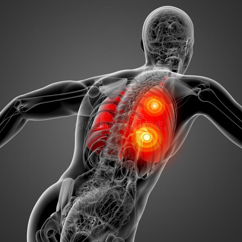 3D Rendering Illustration of Lung Stock Illustration - Illustration of ...