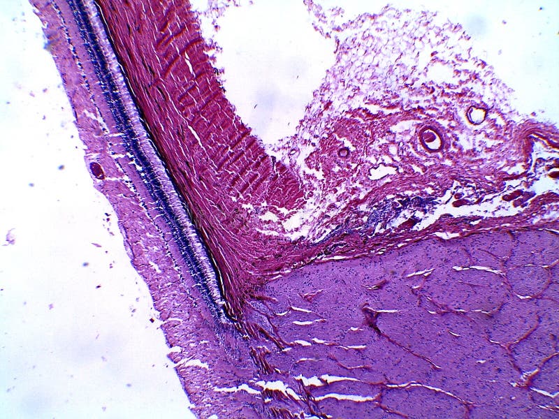 Human Retina and Part of the Blind Spot Under the Microscope Stock ...