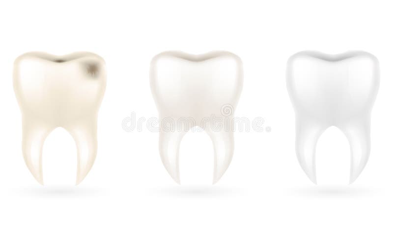 Human Root Tooth Model Vector Illustration Stock Vector - Illustration ...
