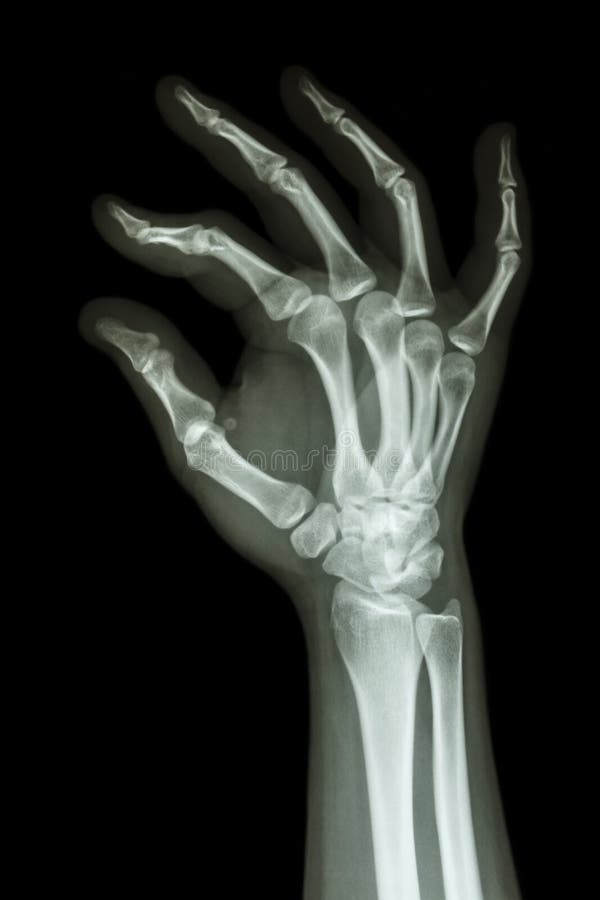 Ok Skeleton Hand Stock Photos - Free & Royalty-Free Stock Photos from ...