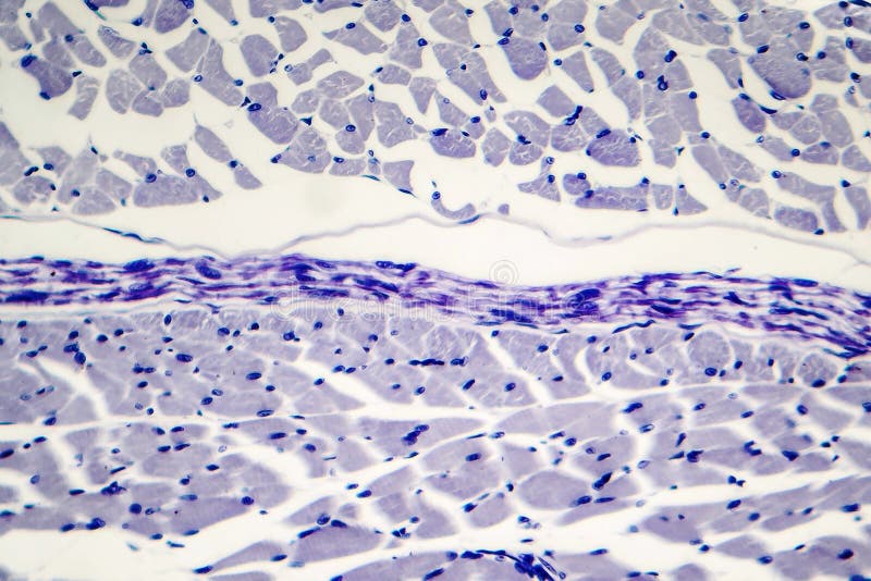 Human Skeletal Muscle Tissue Under Microscope View for Education ...