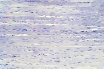 118 Human Skeletal Muscle Light Micrograph Stock Photos - Free ...