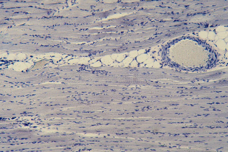 Human Skeletal Muscle Under The Microscope Stock Photo - Image of ...