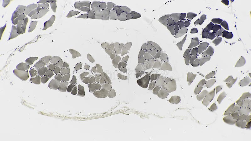 Skeletal Muscle In Longitudinal Section Under Microscope Filmed With 100 Times Magnification