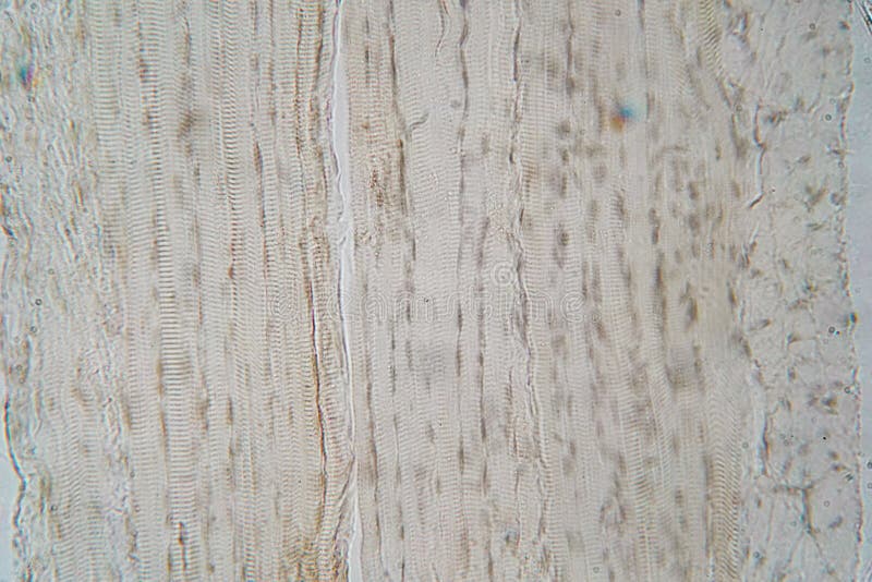 Human Skeletal Muscle Under Microscope View for Education Histology ...