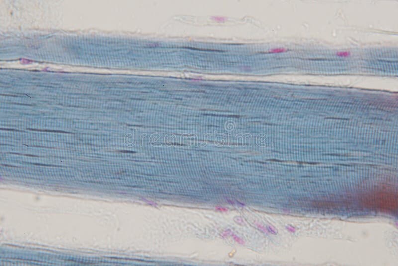 Human Skeletal Muscle Under Microscope View for Education Histology ...