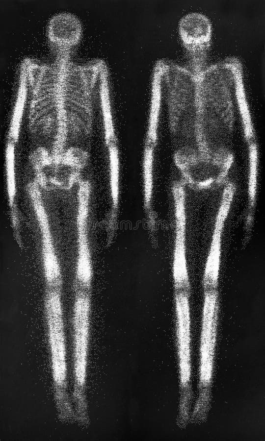 Human Skeleton stock image. Image of body, care, medicine - 37856859