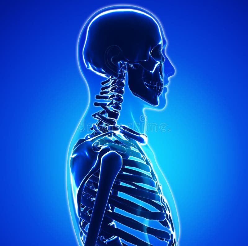 Headache / Migraine with Joint Pain Stock Illustration - Illustration ...