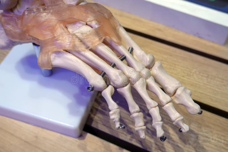 The Human Skeleton Foot Ankle Bone Joint Anatomy Model. Foto de archivo ...