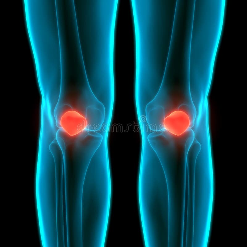 Human Skeleton System Patella Bone Joints Anatomy Stock Illustration ...