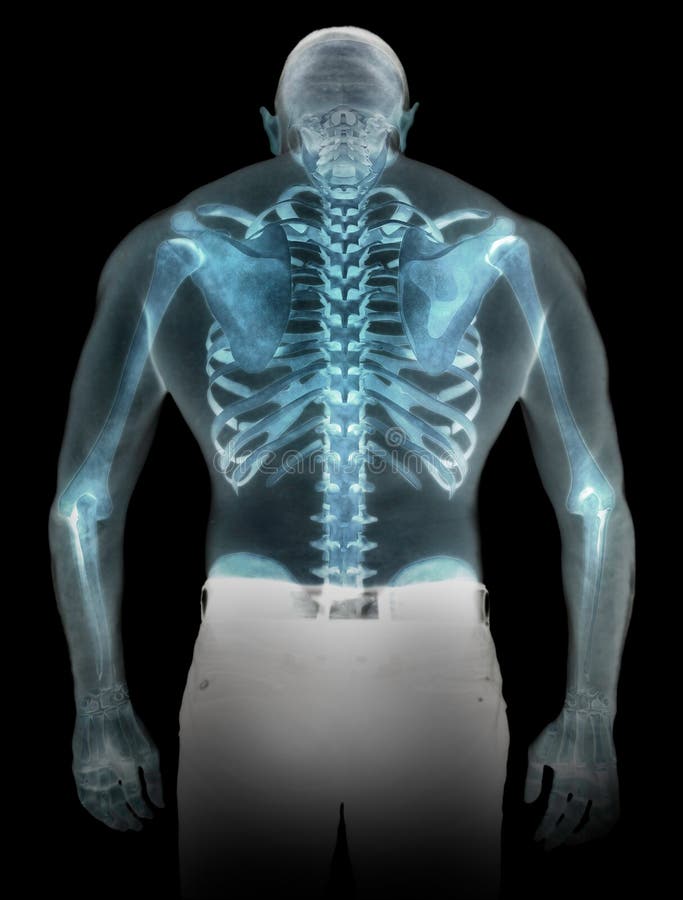Human Skeleton Under the X-rays Isolated on Black Background Stock ...