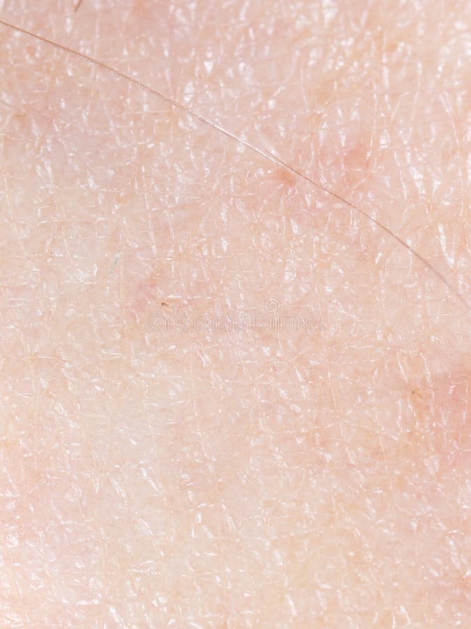 Human Skin As an Abstract Background Stock Photo - Image of pattern ...