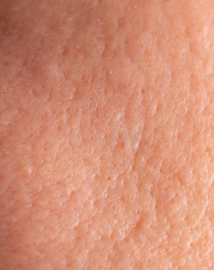 Human Skin As an Abstract Background. Texture Stock Image - Image of ...