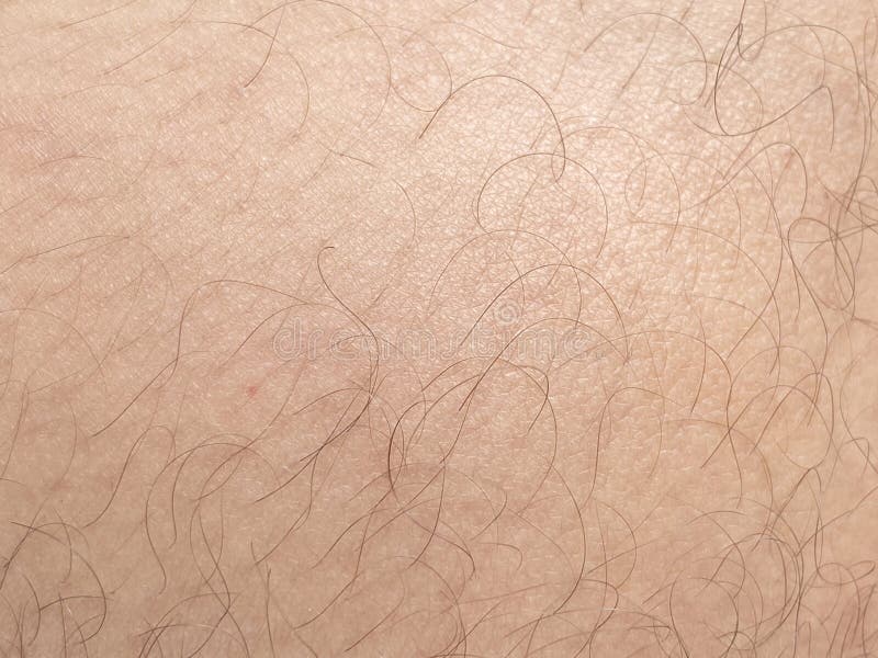 Human skin stock image. Image of people, problem, background - 254215851