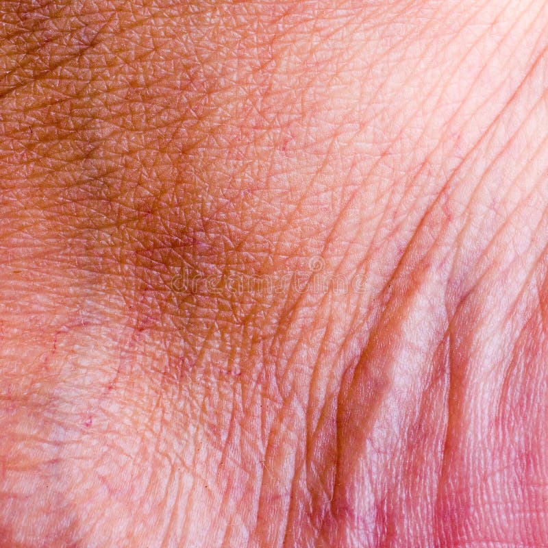 Human skin stock image. Image of background, textured - 17108889