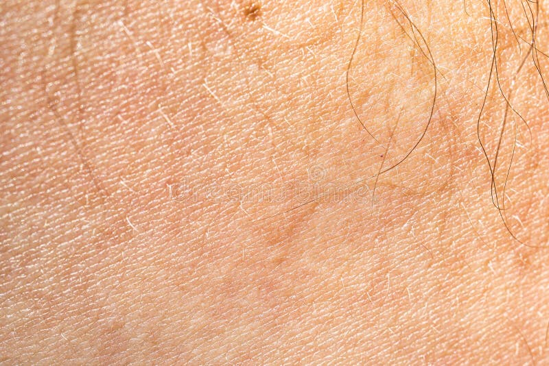 Human Skin Covered with Hair. Stock Image - Image of pink, male: 267799141