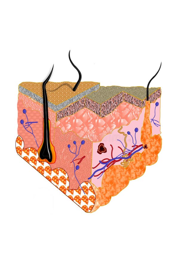 Human skin cutaway diagram stock illustration. Illustration of science ...
