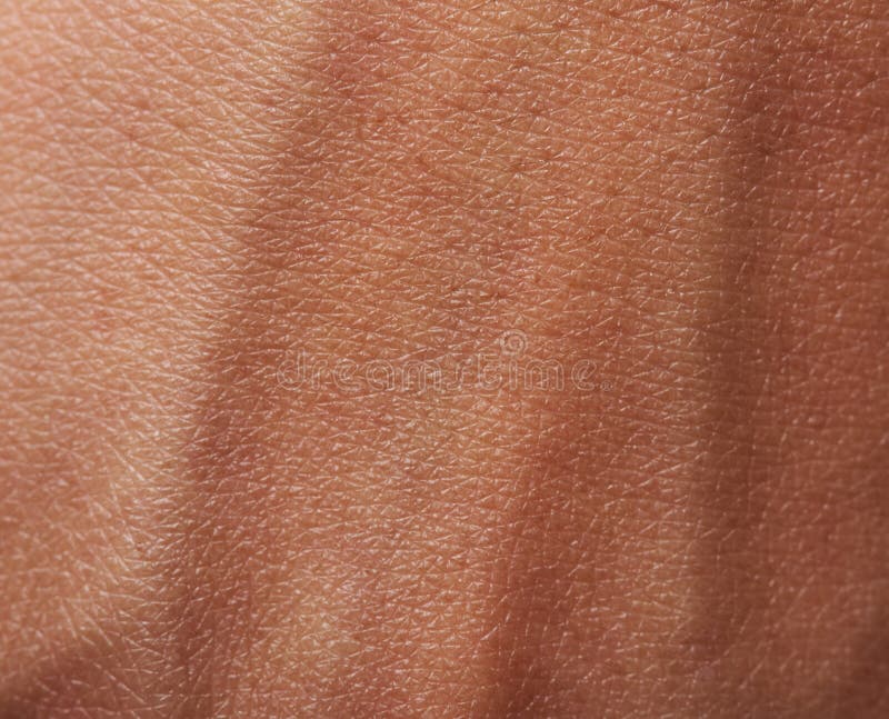 Skin Defects. Woman With Vitiligo Is Praying Stock Image - Image of ...