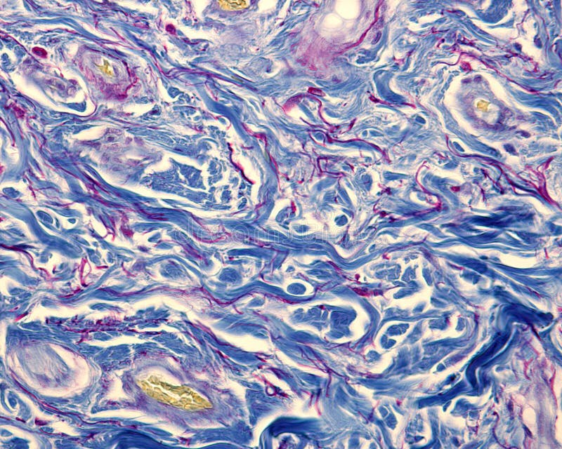 Human Skin Dermis. Elastic Fibers Stock Image - Image of method ...