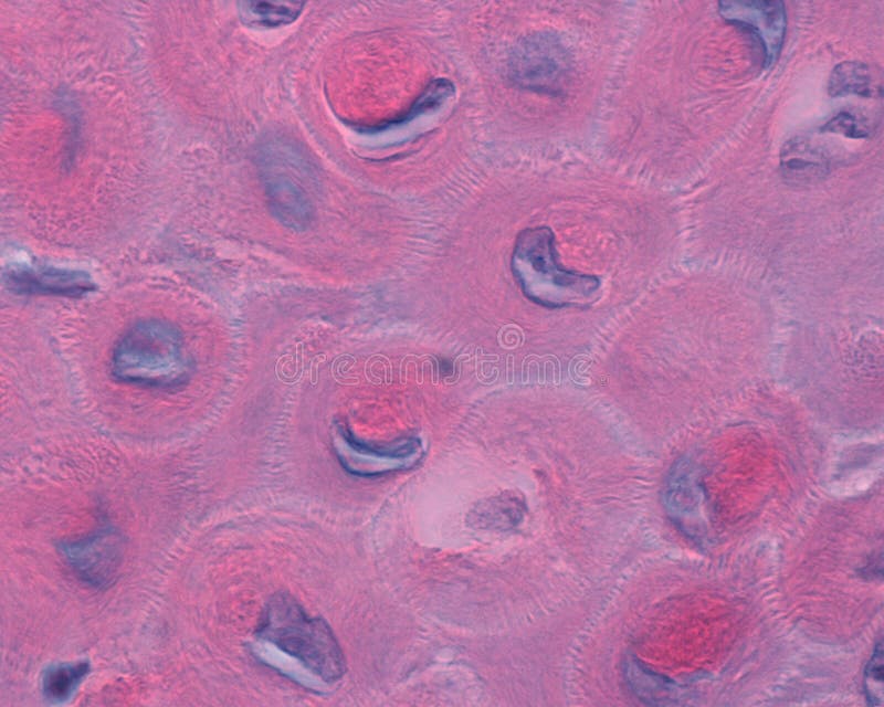 Human Skin. Epidermis. Hyperkeratosis Stock Photo - Image of ...