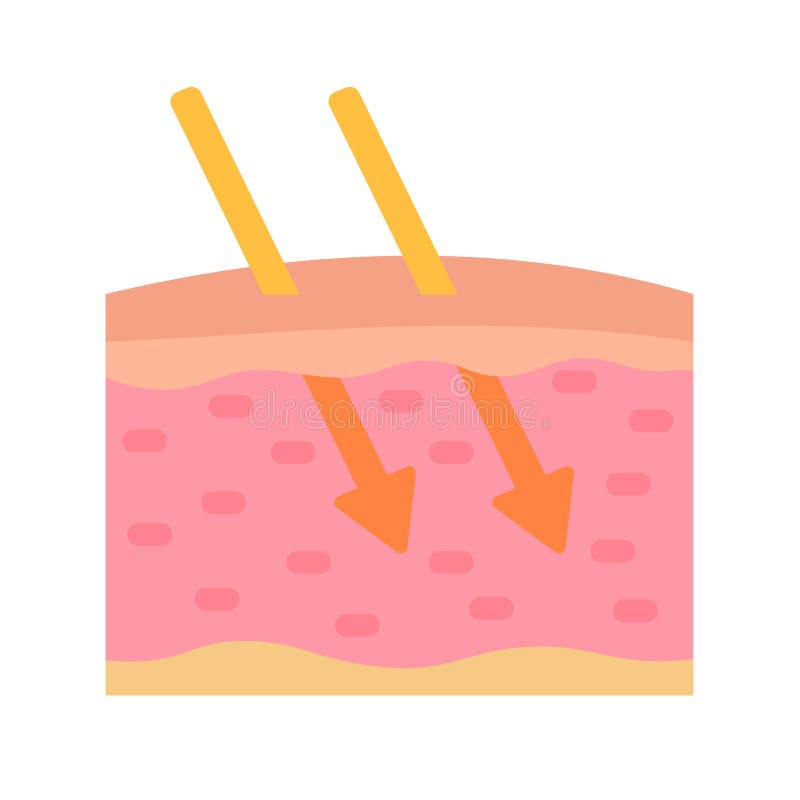 Sun Damage Skin Diagram Stock Illustrations – 113 Sun Damage Skin ...