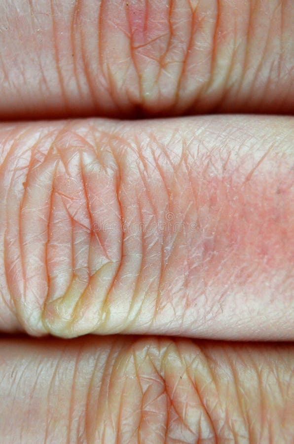 5,163 Finger Skin Texture Stock Photos - Free & Royalty-Free Stock ...