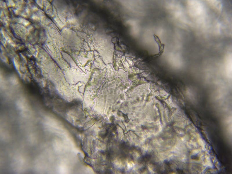 Human Skin Sample in Microscope Stock Image - Image of covering, organ ...