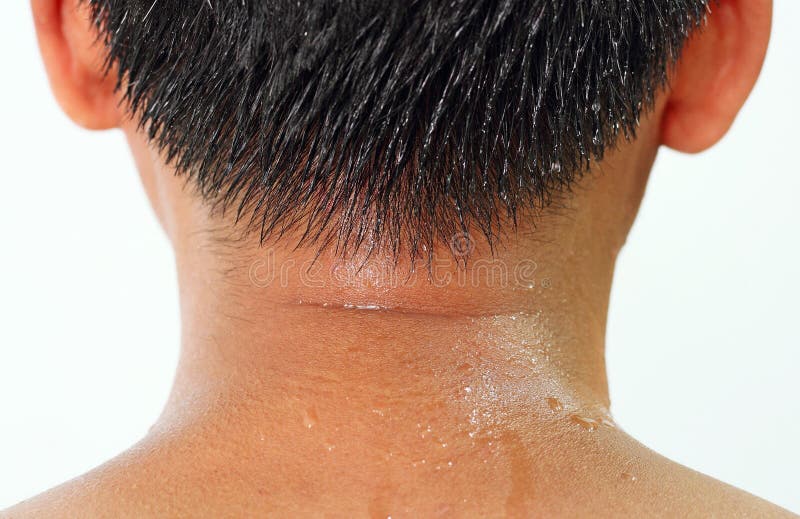 Human Skin and Sweat stock photo. Image of dermatology - 81071732