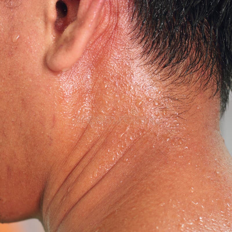 Human Skin and Sweat stock image. Image of science, peel - 77230821