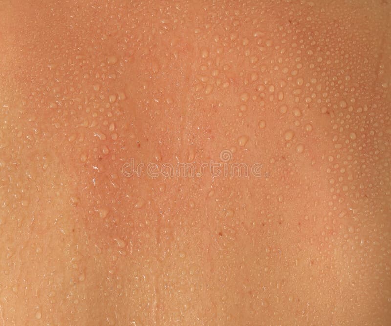 Human Skin and Sweat stock photo. Image of abstract, complexion - 81064830