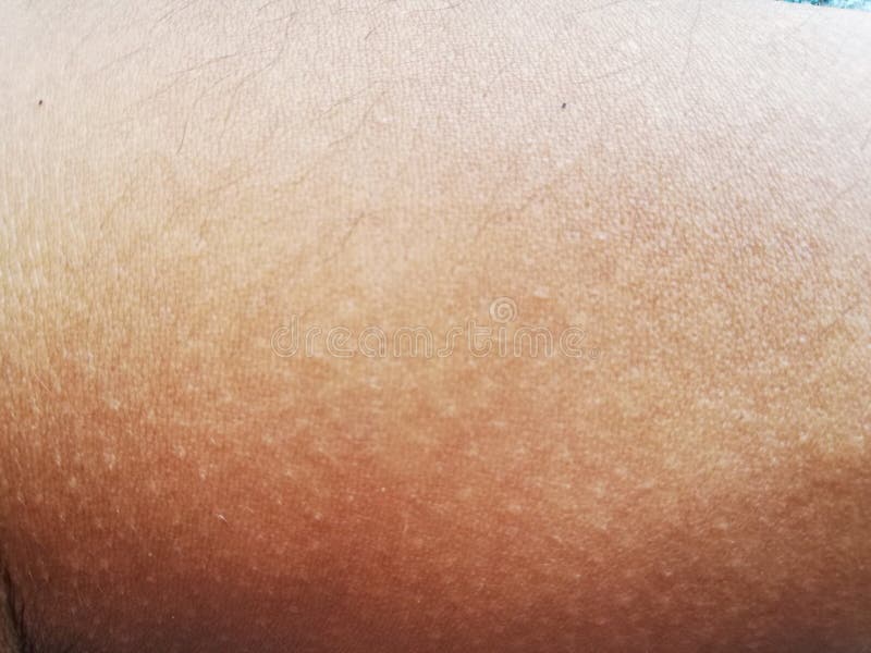 Human Arm Skin Texture