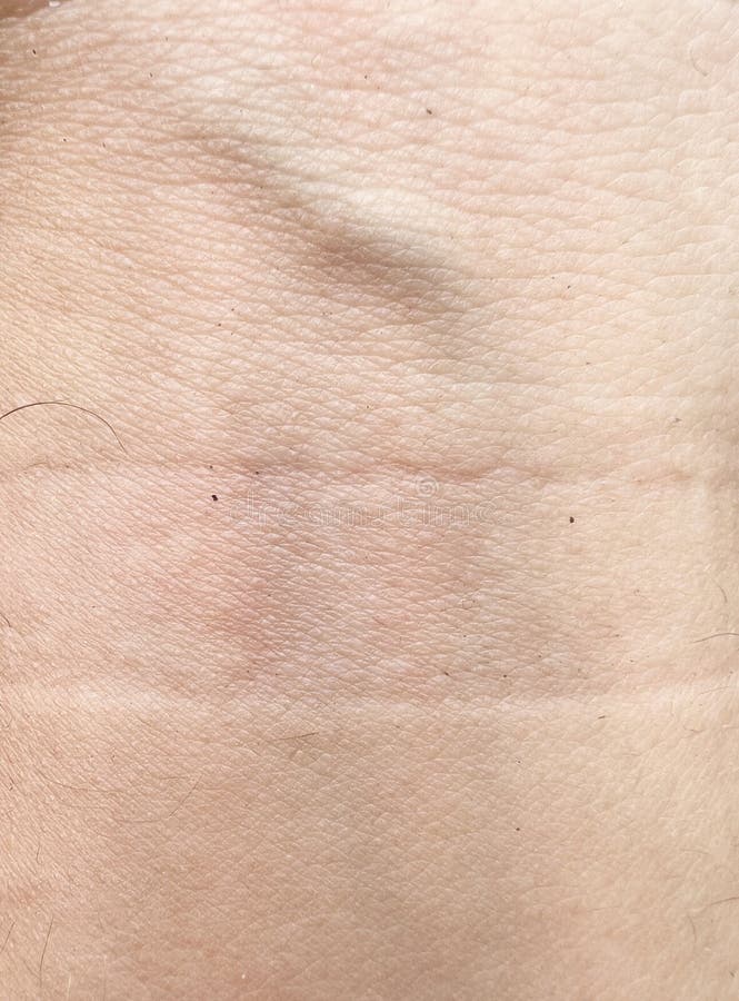 Human skin texture stock photo. Image of close, health - 252933800