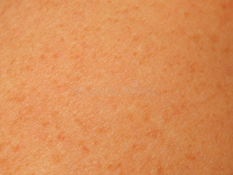Human Skin Texture in Various Parts Stock Photo - Image of human ...