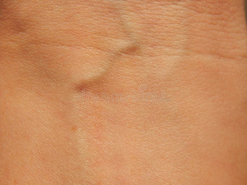 Human Skin Texture in Various Parts Stock Image - Image of textured ...