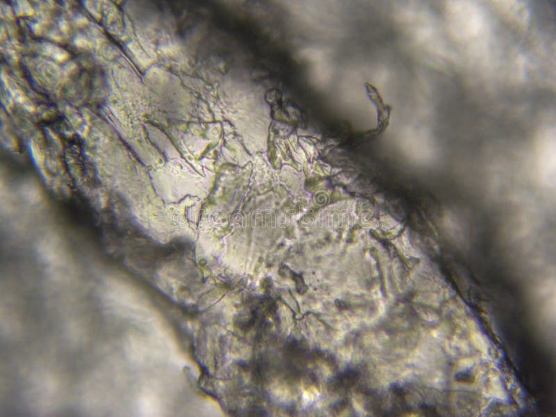 730 Skin Under Microscope Photos - Free & Royalty-Free Stock Photos ...