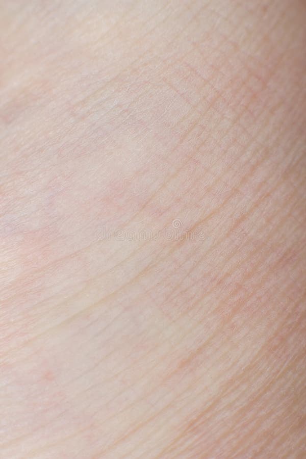 Human Skin with Wounds and without Close Stock Photo - Image of closen ...