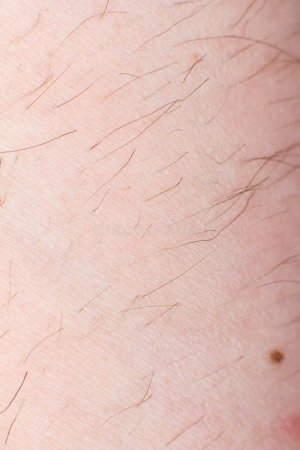 Human Skin with Wounds and without Close Stock Photo - Image of ...