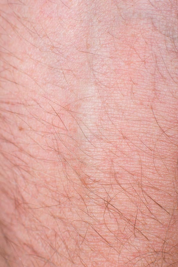 Human Skin with Wounds and without Close Stock Photo - Image of male ...