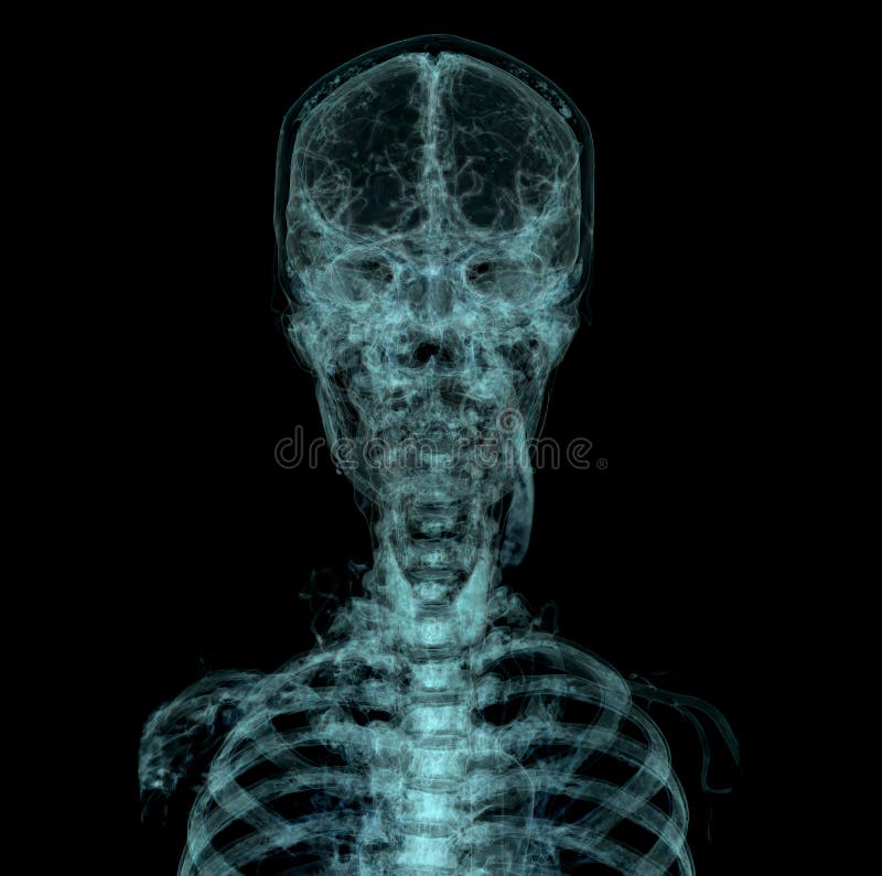 Human Skull, Brain by CT Scan. X-ray Visualization Inside of Skull ... Human Skull, Brain by CT Scan. X-ray Visualization Inside of Skull ...